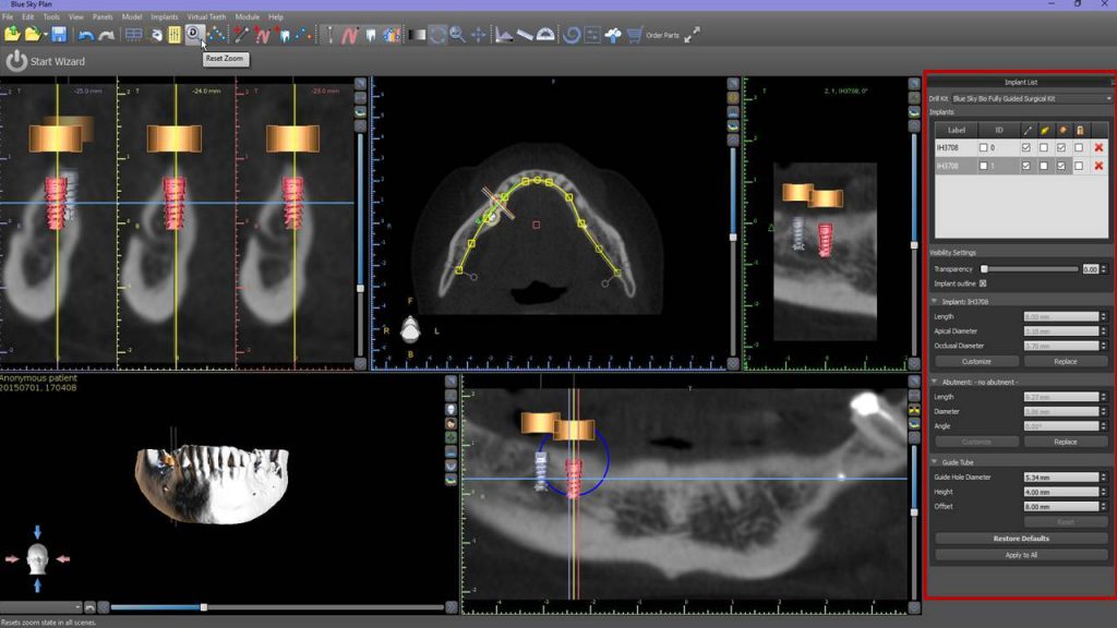 blue sky plan - dentalcrack.com